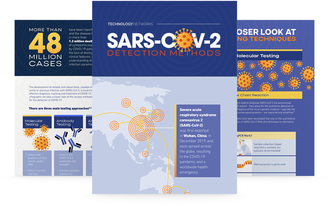Sars Cov 2 Detection Methods